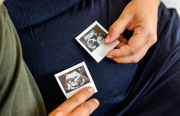 Career Criminal Sets Pregnant Girlfriend On Fire, Judge Lets Him Go ...