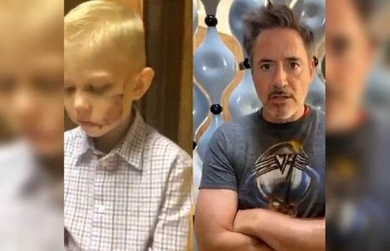 Boy Says He’s ‘Proud’ Of Scars He Received Saving His Little Sister’s Life