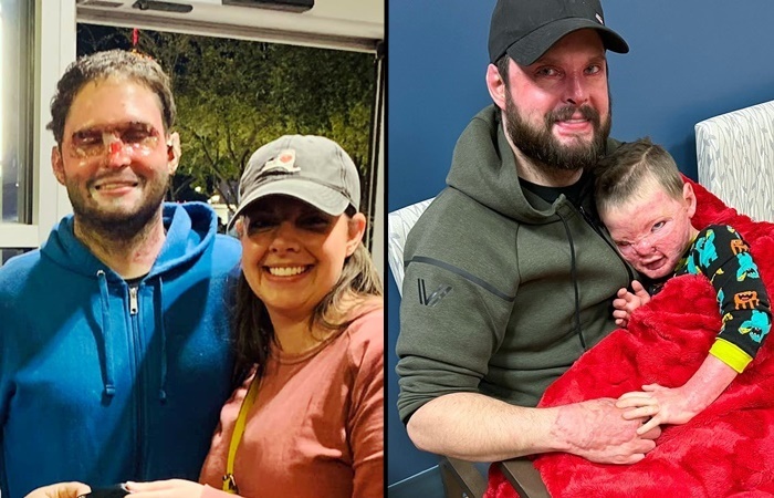 ‘Like Looking Into Hell’: Dad Runs Into Fiery Bus Explosion To Save Kids